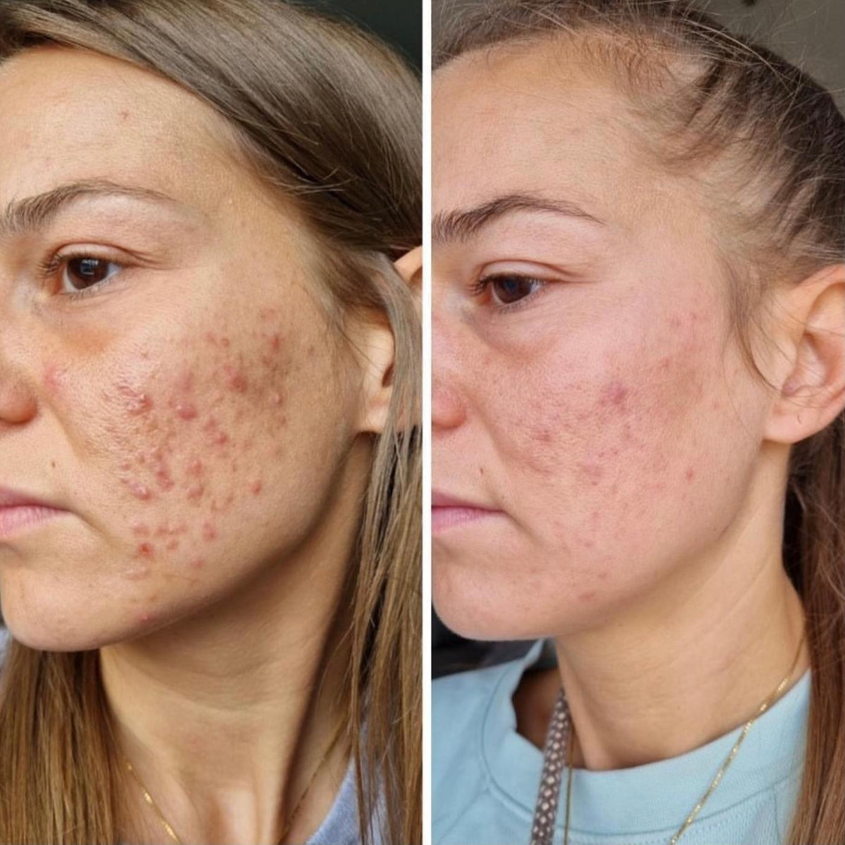 Alex&eve | Deine Reise zu reiner Haut & Selbstliebe